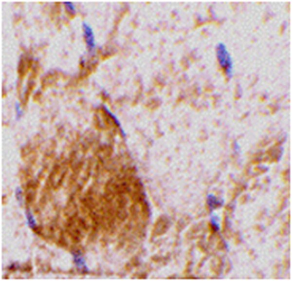 Anti-IL-31 Antibody | ABS455